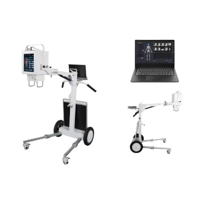Portable DR X-Ray Machine System Mobile Digital Imaging Equipment ...