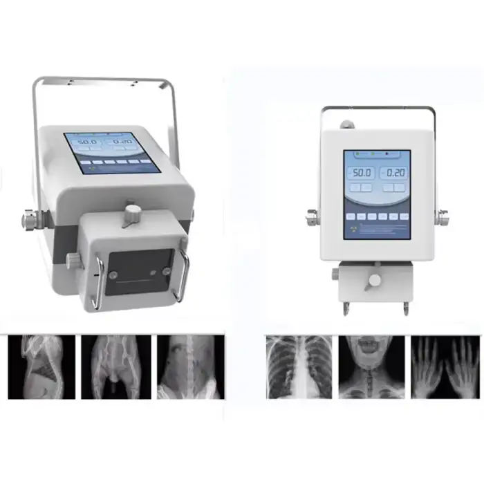 Medical Mobile Digital X Ray Machine Portable Xray Machine Medical X ...