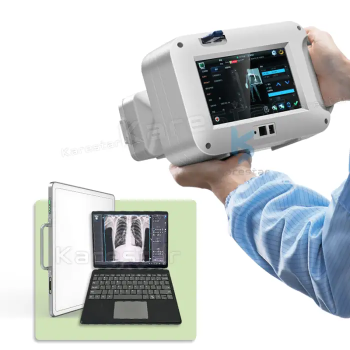 K-DX70 Portable Medical X Ray Digital Machine for Human Use Hospital ...
