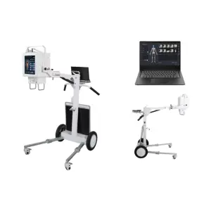 Portable DR X-Ray Machine System Mobile Digital Imaging Equipment ...